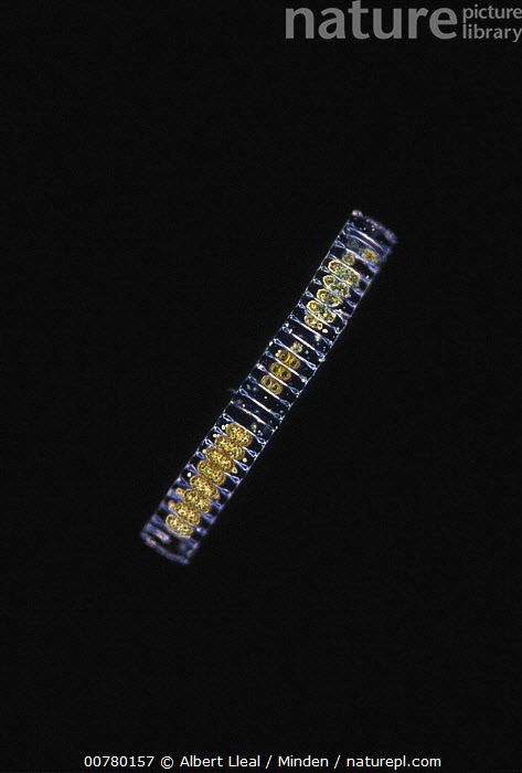 Stock photo of Diatom chain at 30x magnification, Spain. Available for ...