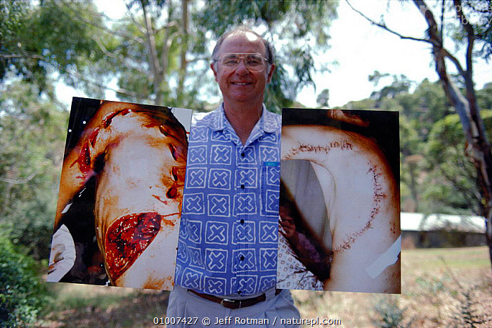 Stock photo of Rodney Fox - Great white shark attack victim with photos ...