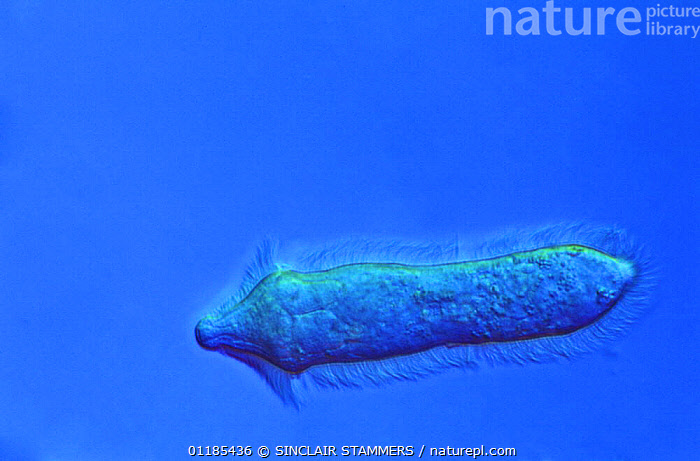 Schistosoma Haematobium