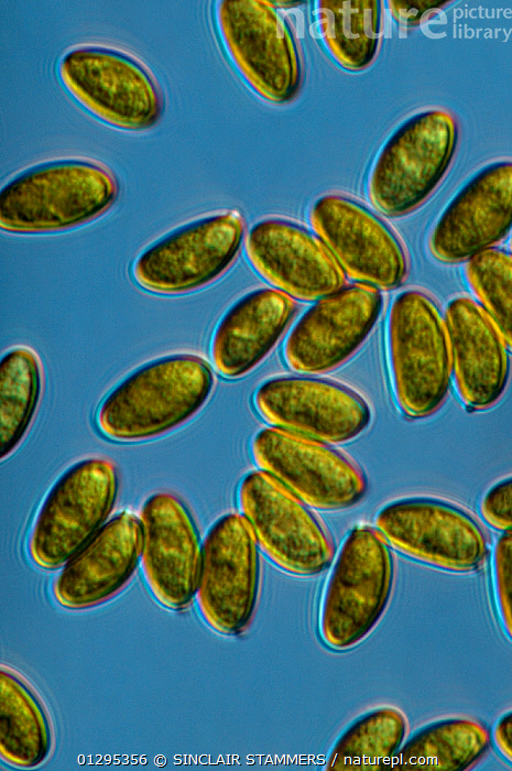 Stock photo of Dry rot (Serpula lacrymans) spores. These are incredibly ...