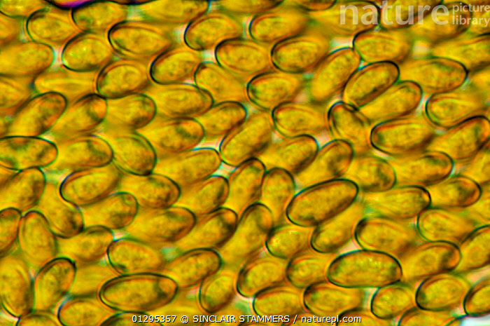 Stock photo of Dry rot (Serpula lacrymans) spores. These are incredibly ...