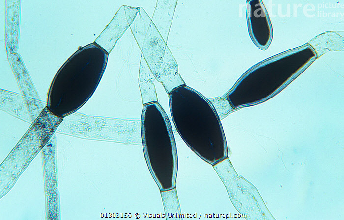 Pithophora Algae