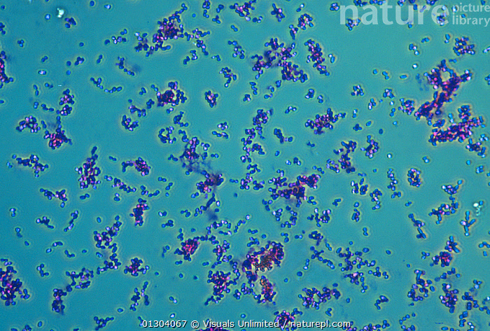 Gram Positive Rods Microscope