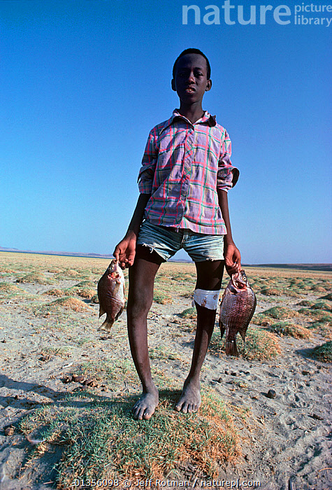 Stock photo of El Molo child suffering from rickets, caused by a diet ...