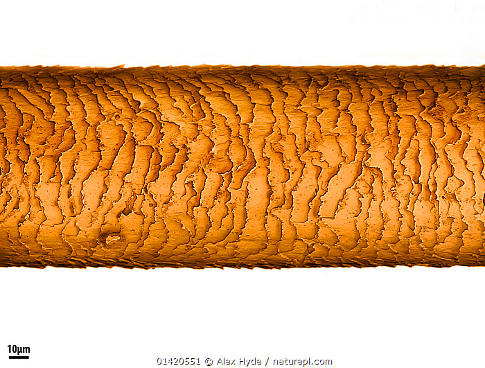 Stock photo of Human hair viewed under a scanning electron microscope ...